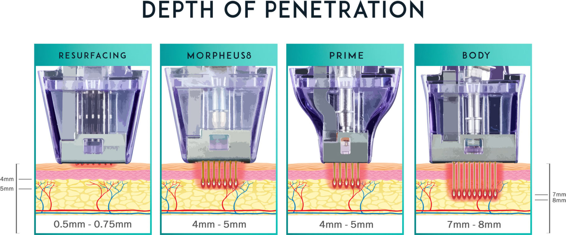 Microneedling vs. RF Microneedling – Synergy Medical Aesthetics ...